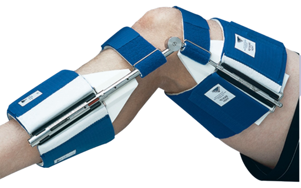 ERMI | Treat Joint Contractures without surgery